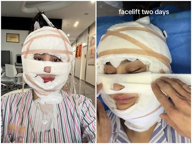 Lâm Khánh Chi băng bó kín mặt, dân tình xót xa: 'Mong kiếp sau chị ...